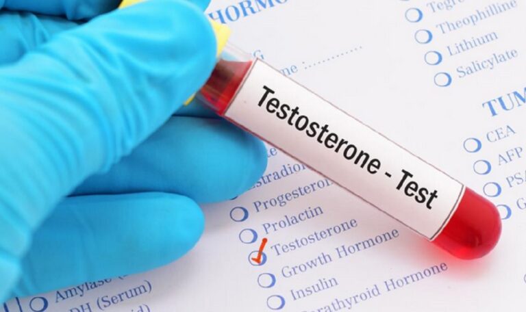 Pse duhet analiza e hormonit të testosteronit - Me Mjekun